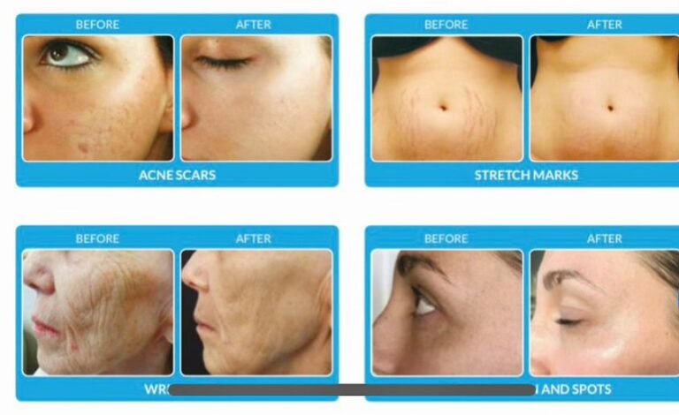 Procell MD System | Smooth Reflections Skincare and Waxing Studio